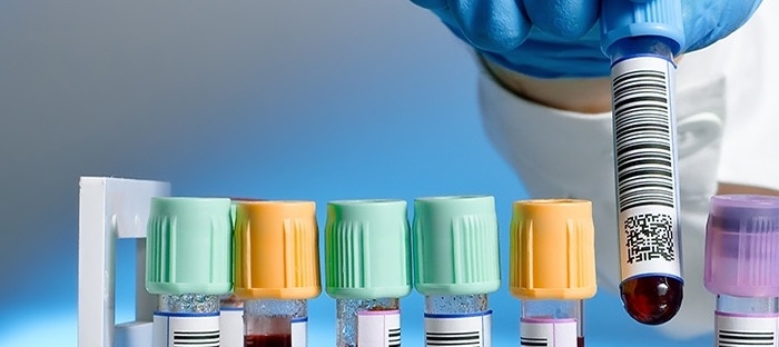 CDC Provides Self-Assessment Checklist for Good Testing Practices with ...
